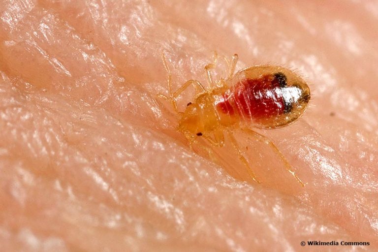 Bettwanzen-Stiche erkennen: so sehen sie aus